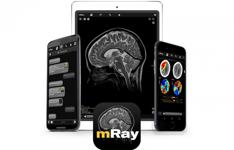 mRay - mbits imaging GmbH - mRay -Die App für Ärzte