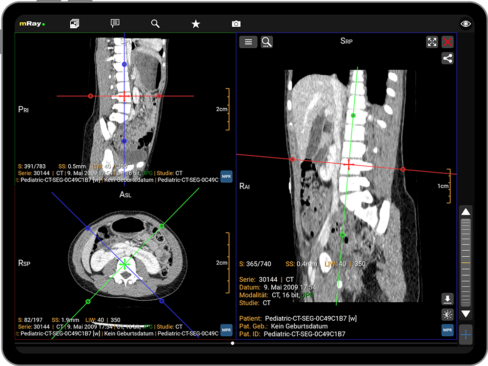 How To MRay Mbits Imaging GmbH Heidelberg How To MRay Mbits Imaging GmbH Heidelberg
