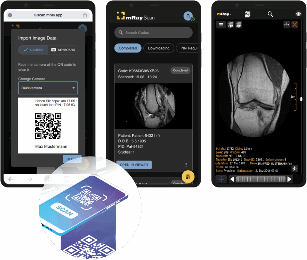 mRay Scan - mbits imaging GmbH - mRay - Die App für Ärzte